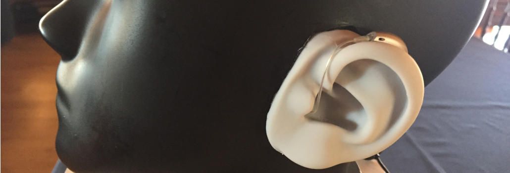 ¿Conoces la Cofosis o Anacusia?